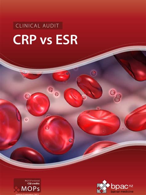 Crp Versus Esr C Reactive Protein Inflammation