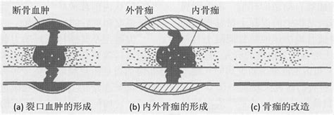 海洋混凝土仿生自修复技术研究进展 Research Progress On Bionic Self Healing Technology Of
