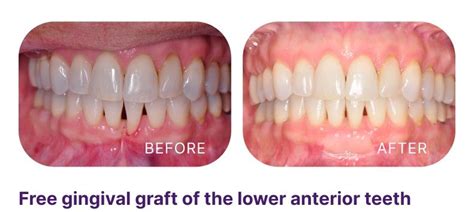 Gallery Periodontist In Greensboro Nc
