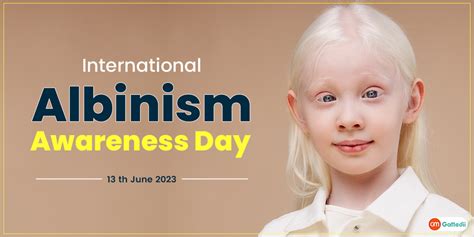 Breaking The Chains Of Stigma Embracing Humanity In Albinism The Mt