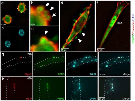 Dynamic Localization Of Rbm3 In Differentiating Primary Myoblasts A