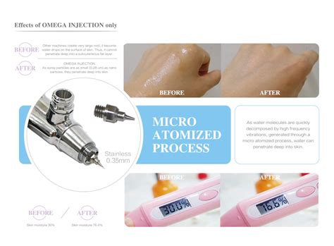 Omega Injection Tradekorea