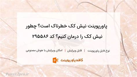 دانلود پاورپوینت نیش کک خطرناک است؟ چطور نیش کک را درمان کنیم؟ کد 295586