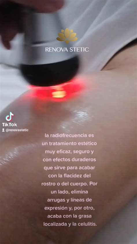 Renova Stetic Santa Bárbara