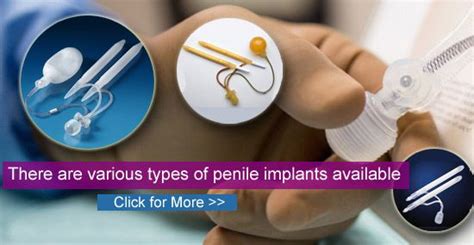 UrologyCareIndia Uro PenileImplantSurgery UroCareINDIA Urocareindia Com