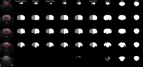 T2 Weighted Image Ground Truth And Automatic Segmentations Of The Rat Download Scientific