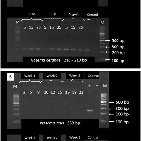 Microscope Image A Light Microscope Image Of Nosema Spp Spores On Download Scientific