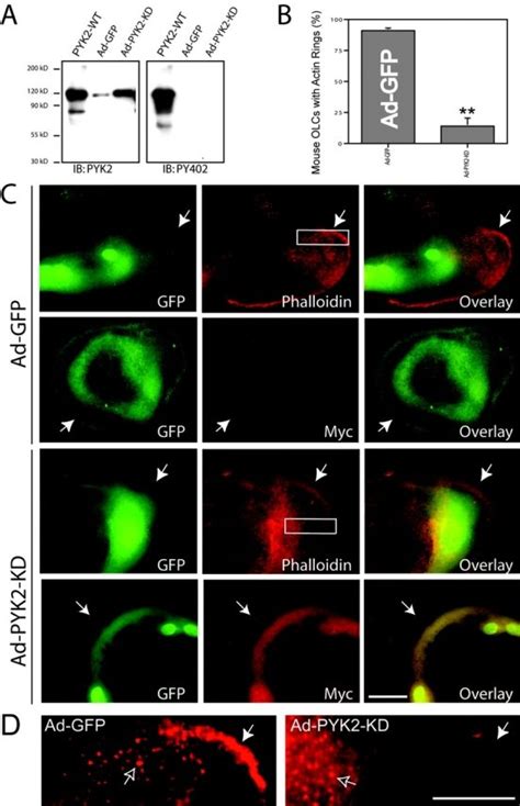 Requirement Of Pyk2 Activity For The Formation Of Actin Rings And Cell
