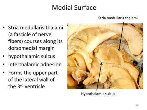 4 Thalamus Pptx Brain And Nervous System Disorders Diseases And