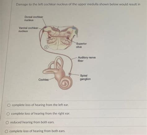 Solved Damage To The Left Cochlear Nucleus Of The Upper