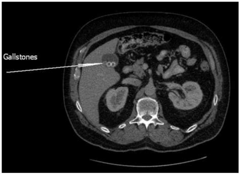 Laparoscopy Origins And Applications Tasc