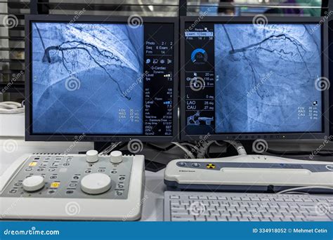 Istanbul Turkey 28 February 2024 Angiogram Sequence Working Clockwise Using X Rays With A
