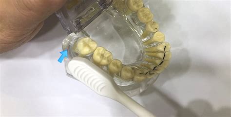 [천안쌍용치과 쌍용동치과] 올바른 칫솔질 방법 네이버 블로그