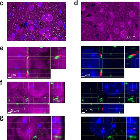 Transneuronal Propagation Of MHTT In Vivo A Low Magnification Image Download Scientific