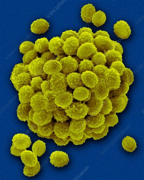 Stachybotrys Sp Toxic Mould Sem Stock Image C0323019 Science