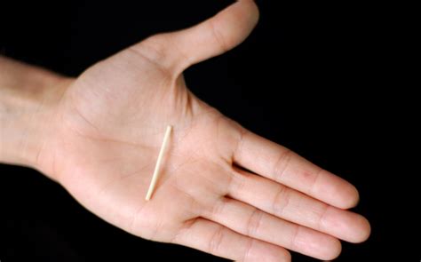 Implante Subdérmico En Cdmx Dónde Lo Ponen Gratis Telediario México