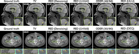 online deep equilibrium learning for regularization by denoising