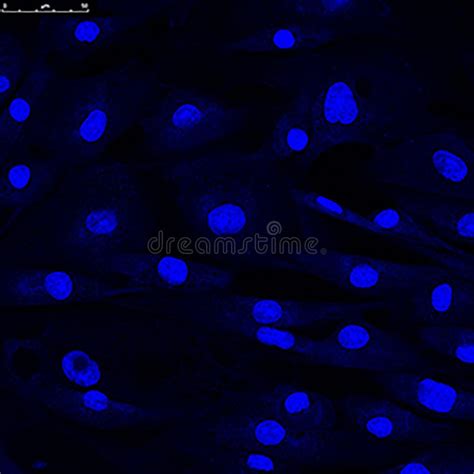 Confocal Microscopy Of Fibroblast Cells Stock Image Image Of Microscope Experiment 75502013