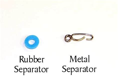 What Are Separators Spacers And Orthodontic Bands Ask An