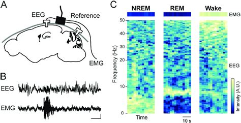 Overview Of The Signal Collection Process For Sleep Scoring In Mice A
