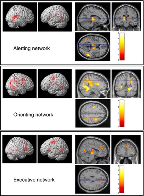 Event Related Fmri Results Indicating Cortical Activation Of The Three
