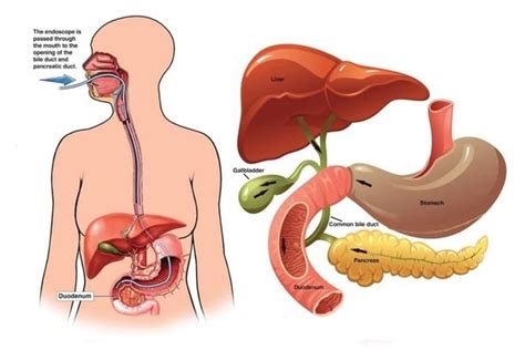 Ercp Diagnostic Medicstreet
