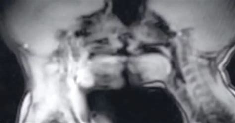 Couple Had Sex In An Mri Scanner And It Shows How Penis Becomes A Boomerang Daily Star