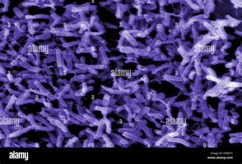 Electron Micrograph Of Clostridium Difficile Bacteria This Anaerobic Gram Positive Rod Is The