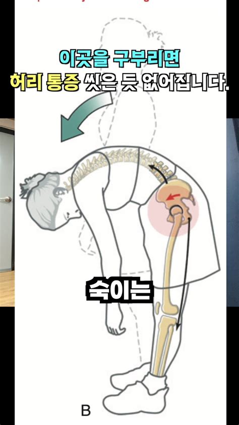 알쓸물치김원득 무릎 통증 이 원리만 알면 누구나 고칩니다 알쓸물치에게 재활을 배우고 싶다면 프로필 링크” 클릭 Instagram