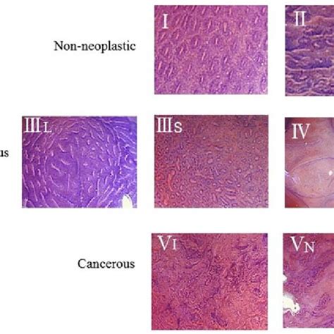 Kudos Pit Pattern Classification Was Composed Seven Type Pit Pattern Download Scientific Kudos Pit Pattern Classification Was Composed Seven Type Pit Pattern Download Scientific