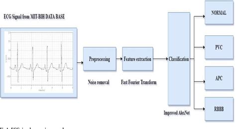 Figure 3 From Classification Of Ecg Signal Using Fft Based Improved