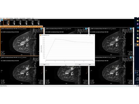 Iq View User Friendly Dicom Viewer With Reporting Module