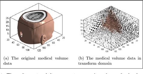 Figure From Zero Watermarking Algorithm For Medical Volume Data Based On Difference Hashing