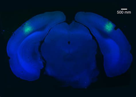 Cortex Visual Visual Cortex Visual Cortex Added A New Photo