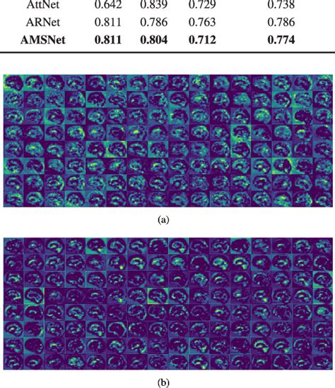 Figure 5 From An Attention Based 3d Cnn With Multi Scale Integration