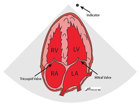Assessing Left Ventricular Ejection Fraction With Echocardiography