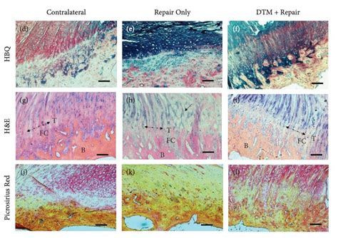 Engineered Dtm Putty Preserves Native Tendon Bioactivity To Promote Cell Proliferation And