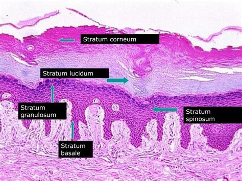 Ppt Integumentary System Powerpoint Presentation Free Download Id