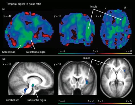 Fluctuations In The Fmri Bold Signal Difference Maps Of Download Scientific Diagram