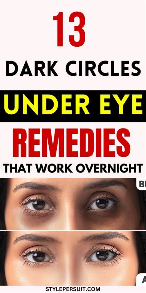 13 Dark Circles Under The Eyes Remedies That Work Fast Dark Circles