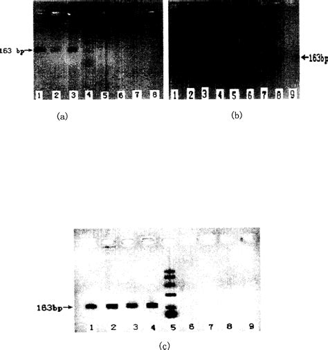 Pcr Amplification Primer Kit And Use Thereof In Identification Of