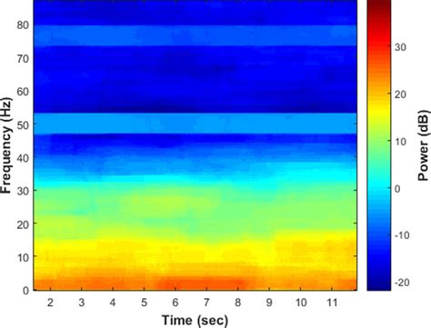 Example Of Spectrogram Extracted In A Normal Eeg Segment Download