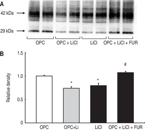 Aqp2 Protein Expression After Combination Therapy A Signal Bands Of