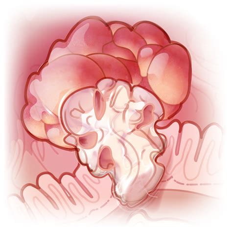 Nejm Illustrated Glossary