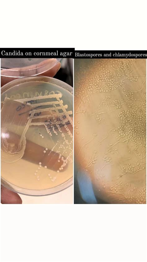 Priyanka Yadav On Linkedin Asexual Spores Called Blastoconidia Blastospores Develop In Clusters…