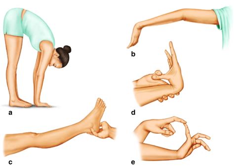 What Causes Adolescent Idiopathic Scoliosis Insights