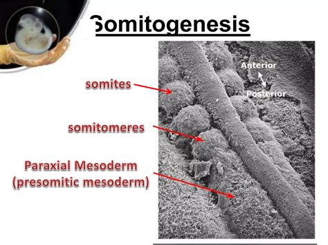 Paraxial And Intermediate Mesoderm Pptx