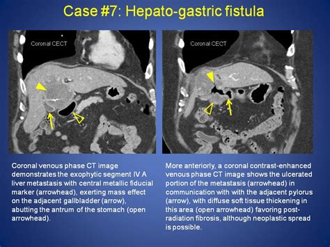 Gastrointestinal Learning Modules Ct Scanning Gastrointestinal Learning Modules Ct Scanning