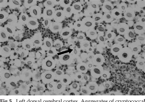 Figure 5 From Cerebral Cryptococcal Granuloma In A Cat Semantic Scholar