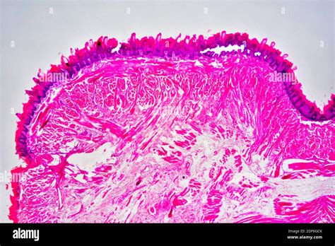 Tongue Papilla Immagini E Fotografie Stock Ad Alta Risoluzione Alamy